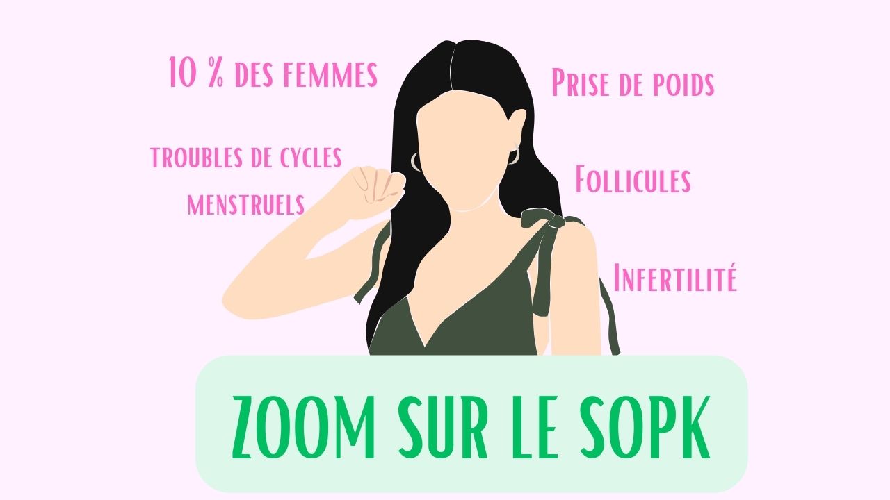 SOPK : qu'est-ce que c'est que le syndrome des ovaires polykystiques