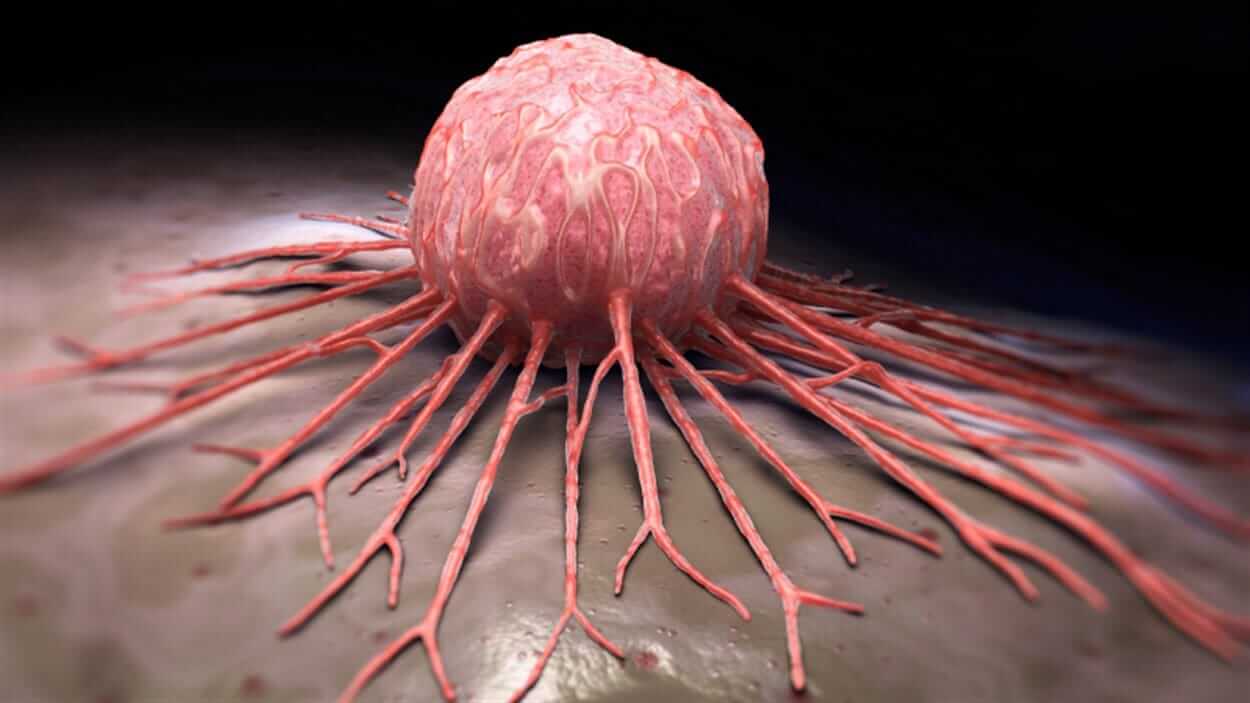 Qu’est-ce que le cancer ? Risques et explications